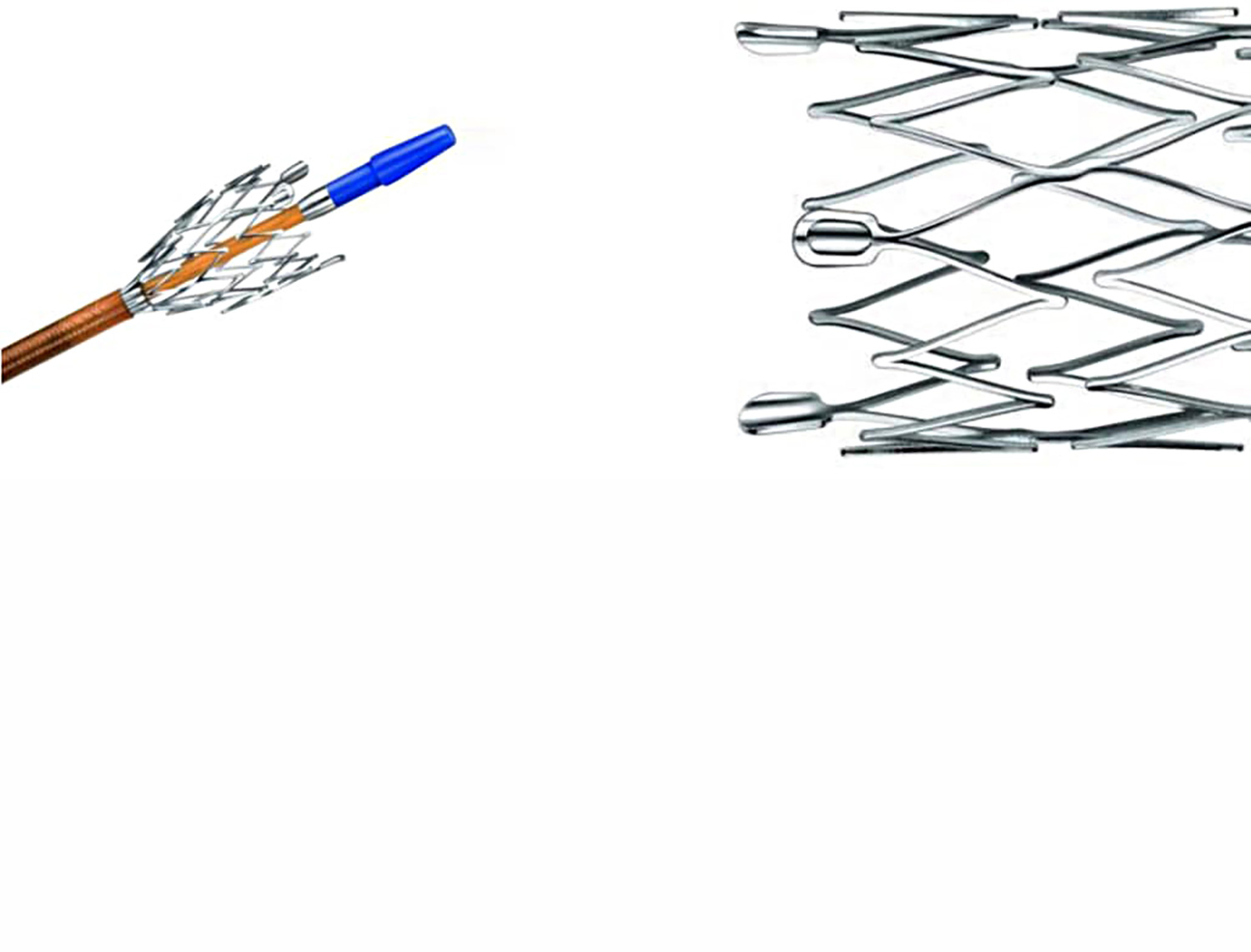 Nitinol Urethra Stent | Dextronix