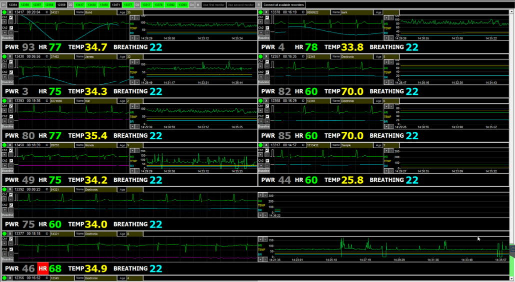 Wireless Automated ICU-Telemetry Systems | Dextronix